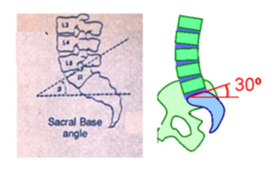 sacral angle 30 deg - Yoga Doctors
